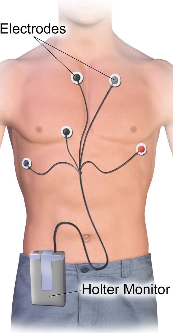 Understanding The Maze Of Cardiac Tests Why Did The Doctor Prescribe